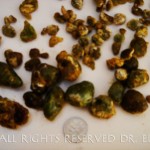 Gallbladder Sludge Pulverexx Overview & Benefits – Remove Gallstones ...