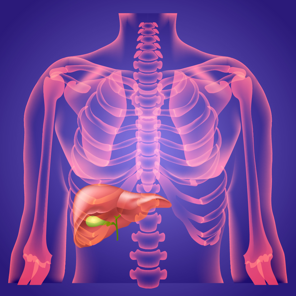 Gallbladder - Remove Gallstones Without Surgery