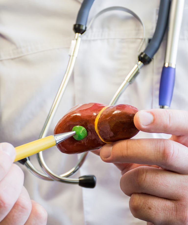 Gallbladder Symptoms: What Does A Sluggish Gallbladder Feel Like ...